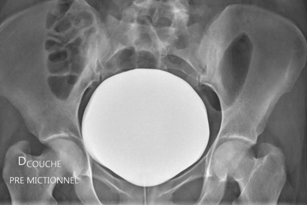 Cystographie | Vidi - IMCL41